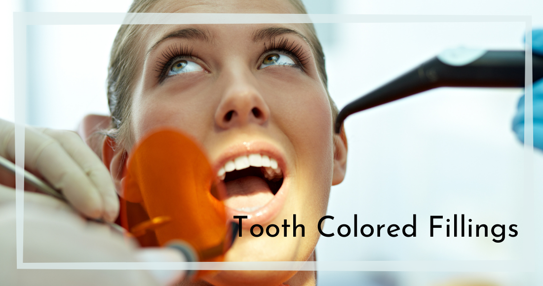 Tooth-Colored Fillings – Dr Brent Moore, DDS